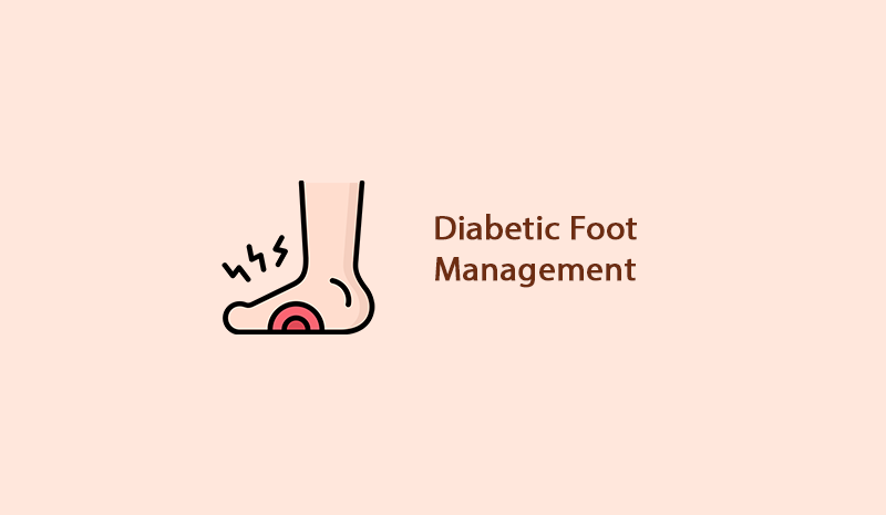 Treatment of Diabetic Foot | KM NU Hospitals, Ambur